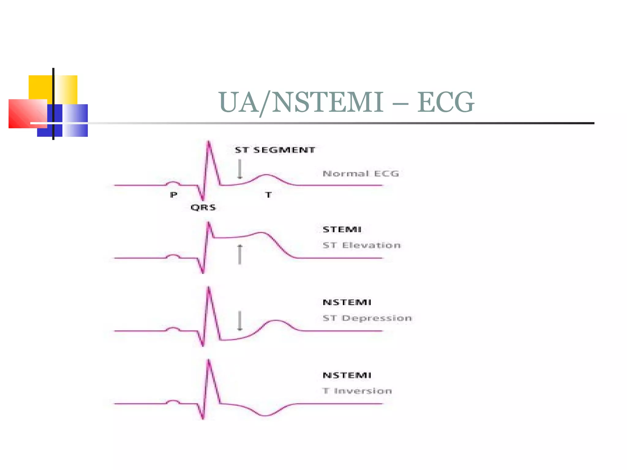 ACUTE CORONARY SYNDROME | PPT