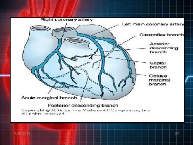 Acs – inferior wall myocardial infarction. by abhimanyu