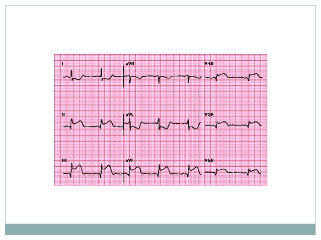 acs.ppt