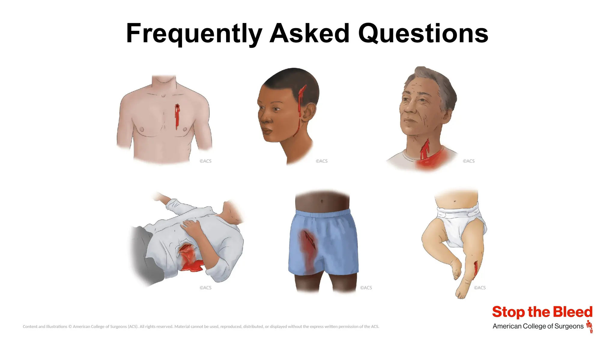 acs-stop-the-bleed-course-version-30 (1) (1).pptx