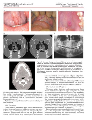 Acs0201 Oral Cavity Lesions | PDF