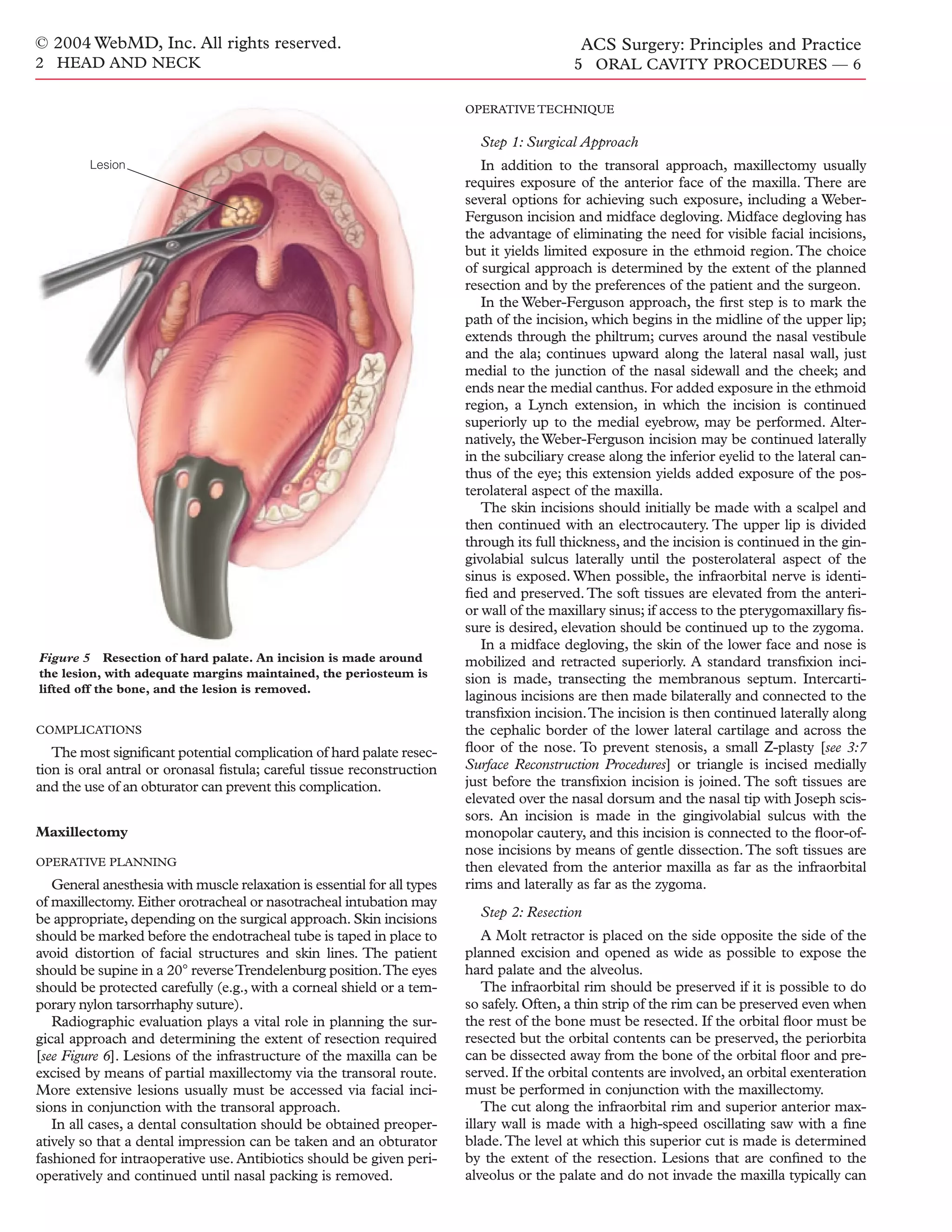 Acs0205 Oral Cavity Procedures | PDF