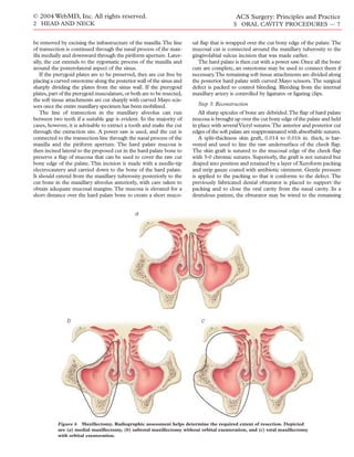 Acs0205 Oral Cavity Procedures | PDF