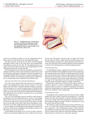 Acs0205 Oral Cavity Procedures | PDF
