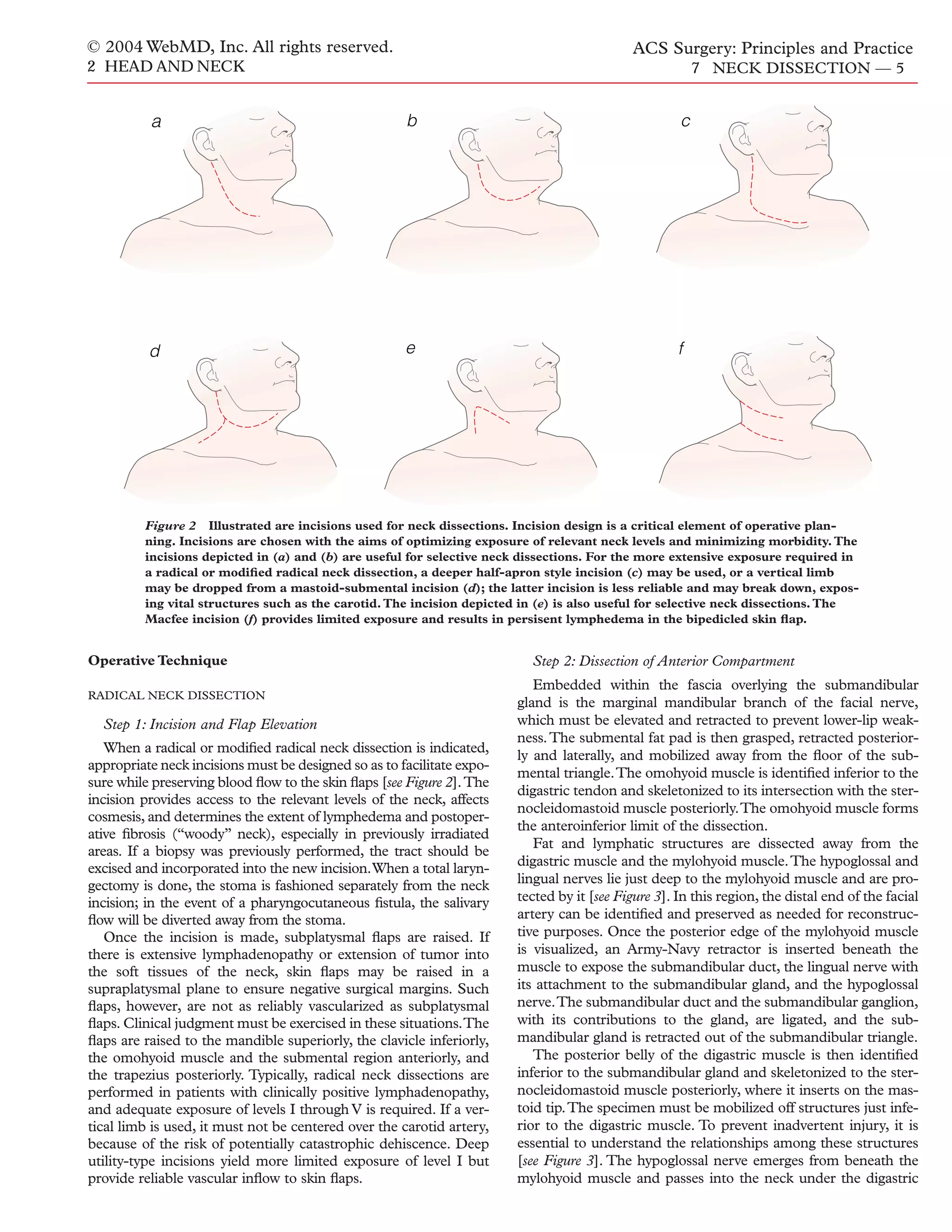 Acs0207 Neck Dissection | PDF