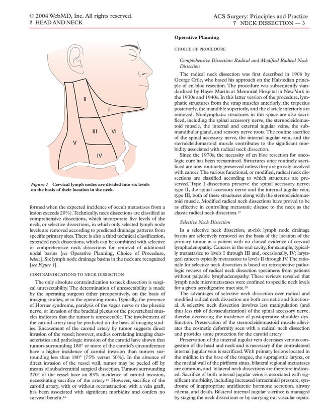 Acs0207 Neck Dissection | PDF