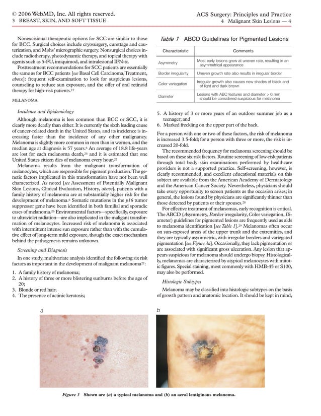 Acs0304 Surgical Management Of Melanoma And Other Skin Cancers | PDF
