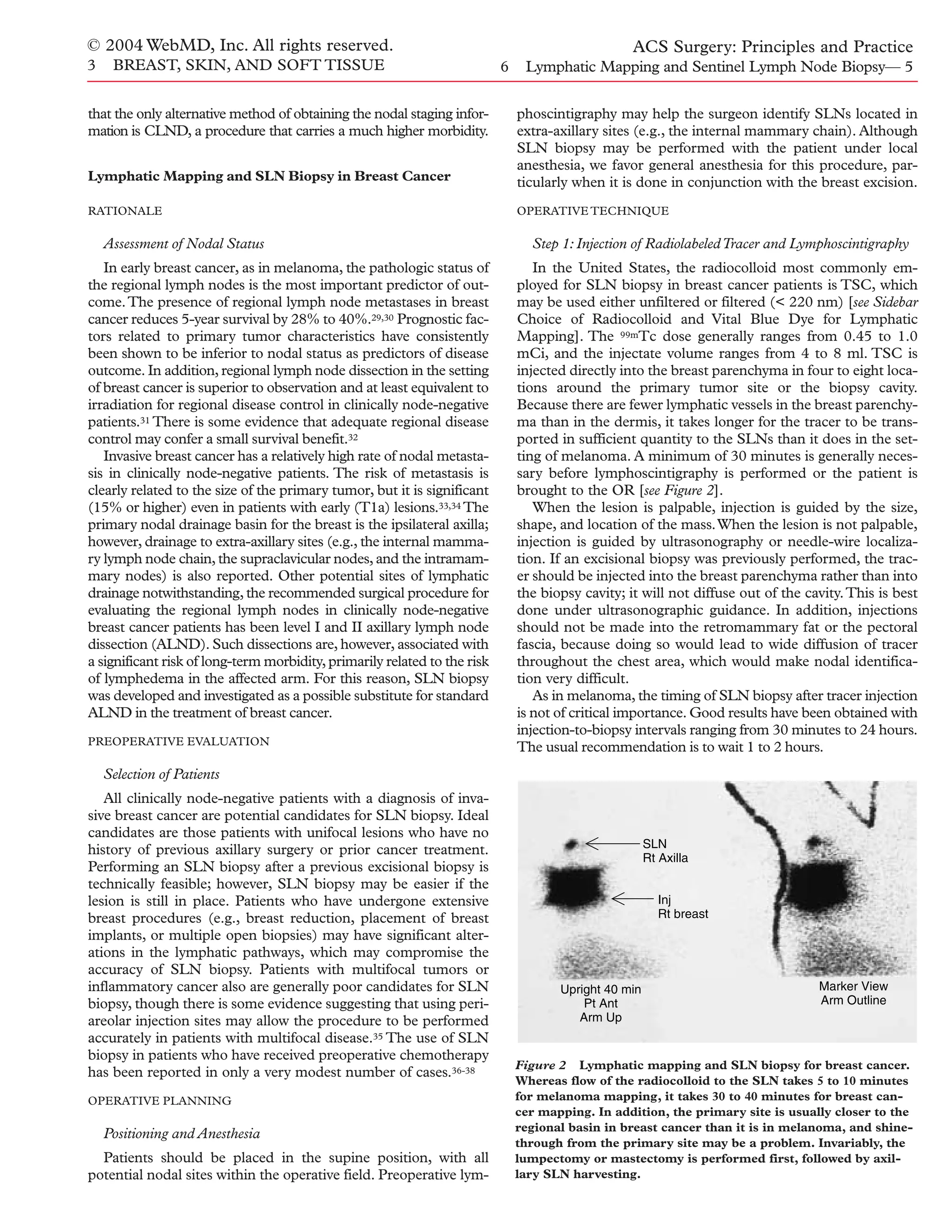 Acs0306 Lymphatic Mapping And Sentinel Lymph Node Biopsy | PDF
