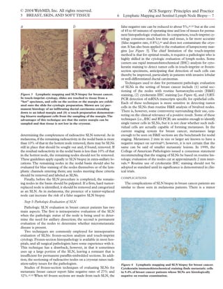 Acs0306 Lymphatic Mapping And Sentinel Lymph Node Biopsy | PDF