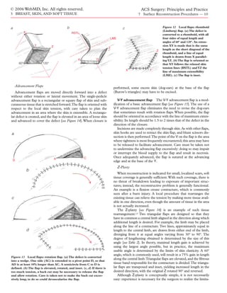 Acs0307 Surface Reconstructive Procedure | PDF