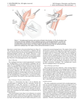 Acs0407 Open Esophageal Procedures | PDF
