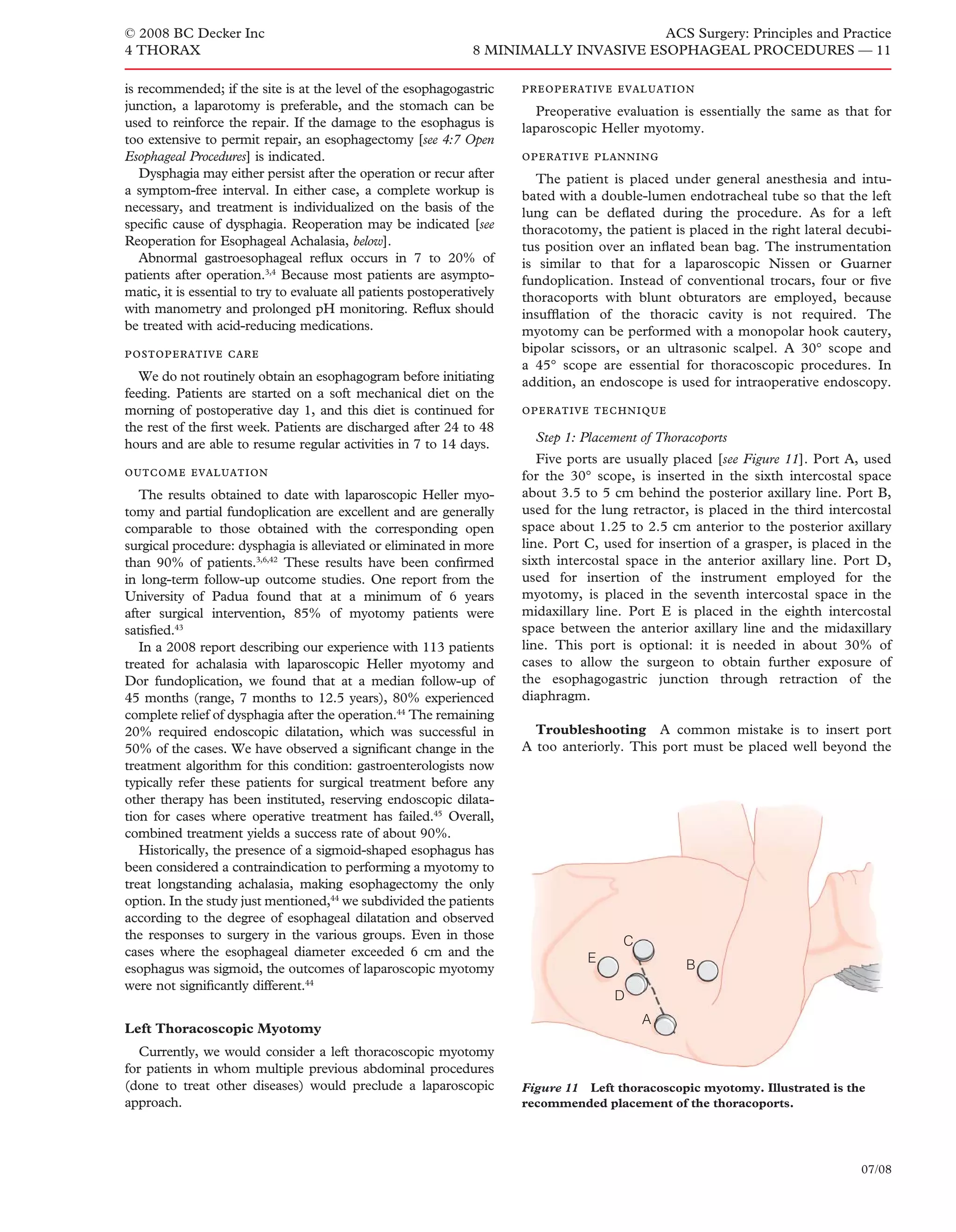 Acs0408 Minimally Invasive Esophageal Procedures | PDF