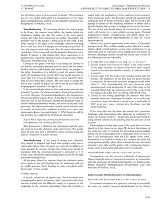 Acs0408 Minimally Invasive Esophageal Procedures | PDF