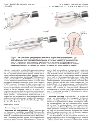 Acs0410 Video Assisted Thoracic Surgery | PDF