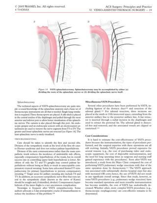 Acs0410 Video Assisted Thoracic Surgery | PDF