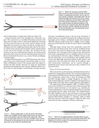 Acs0410 Video Assisted Thoracic Surgery | PDF