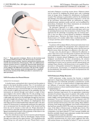 Acs0410 Video Assisted Thoracic Surgery | PDF