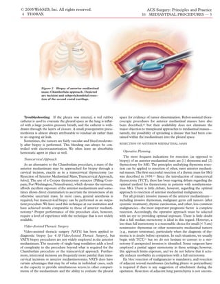 Acs0411 Mediastinal Procedures | PDF
