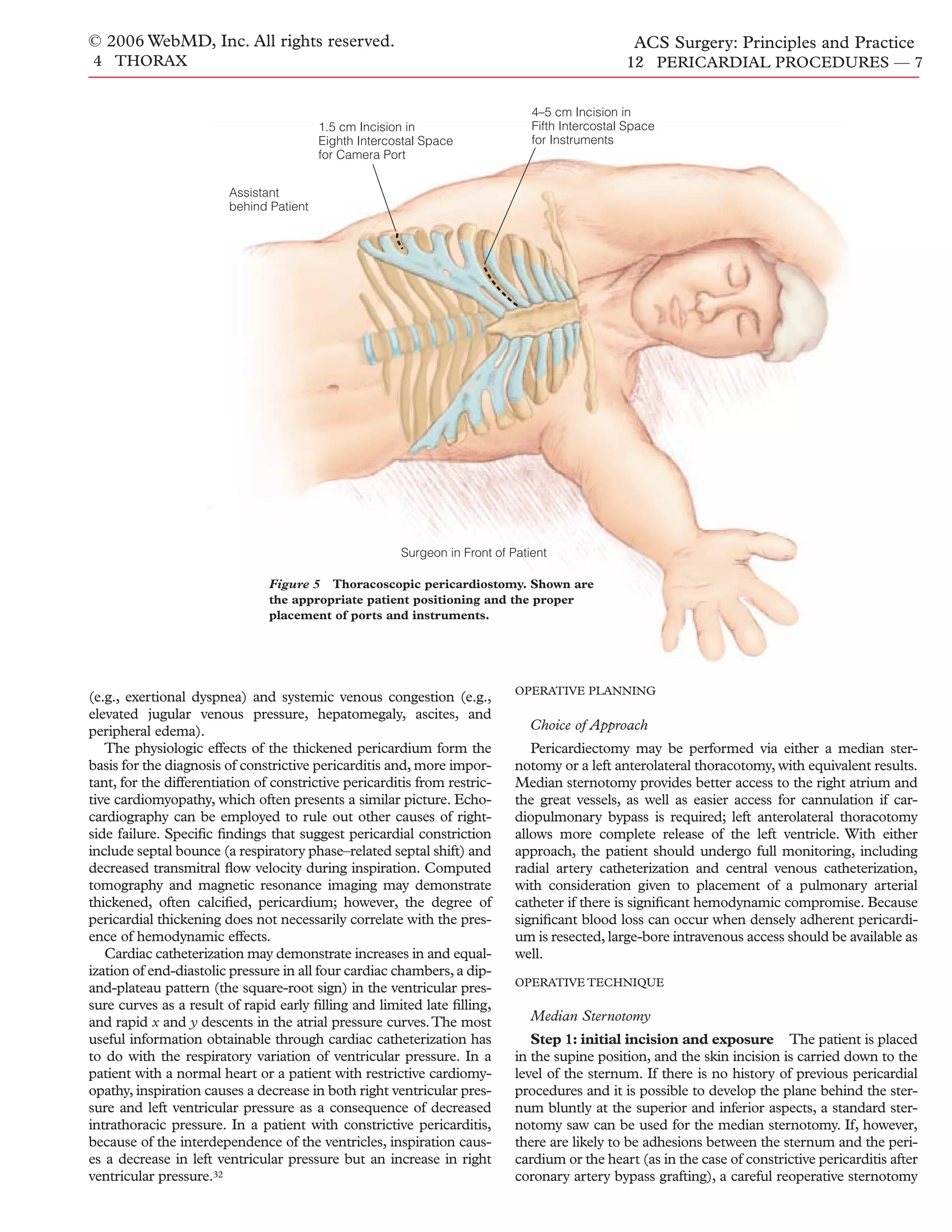 Acs0412 Pericardial Procedures | PDF