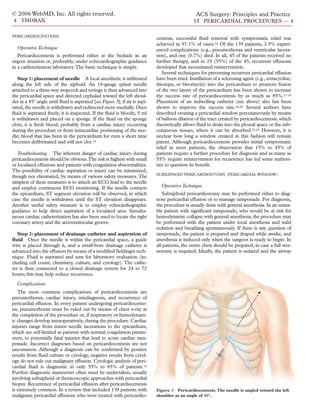 Acs0412 Pericardial Procedures | PDF