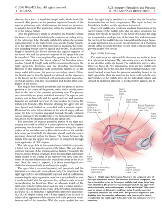 Acs0414 Pulmonary Resection | PDF
