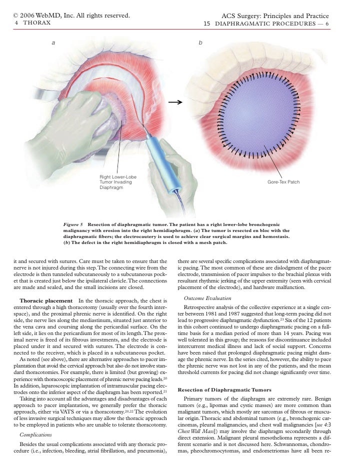 Blog Archives - isoshara