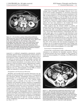 Acs0504 Intestinal Obstruction 2004 | PDF