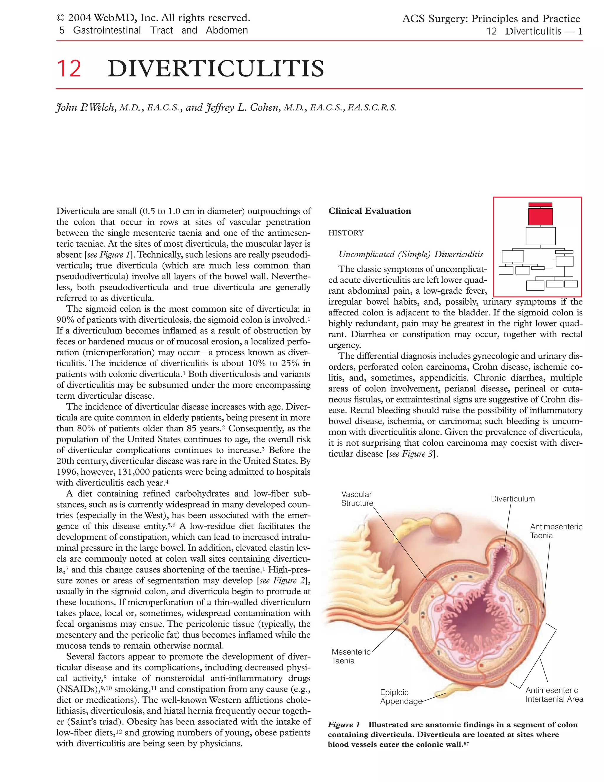 Acs0512 Diverticulitis 2004 | PDF