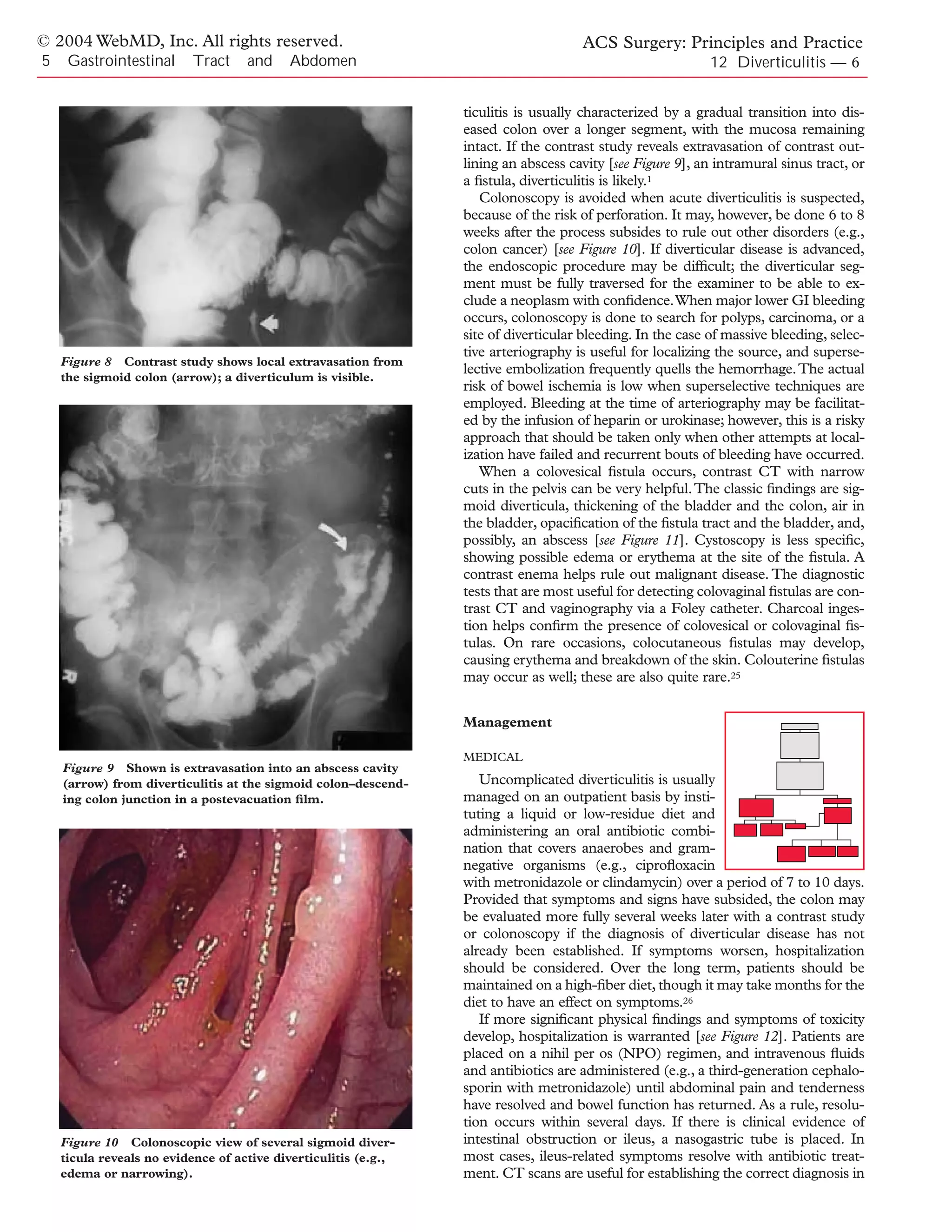 Acs0512 Diverticulitis 2004 | PDF