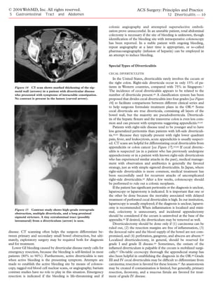 Acs0512 Diverticulitis 2004 | PDF