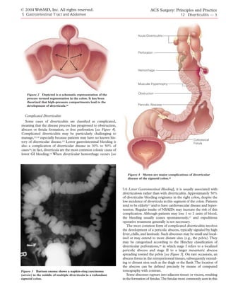 Acs0512 Diverticulitis 2004 | PDF