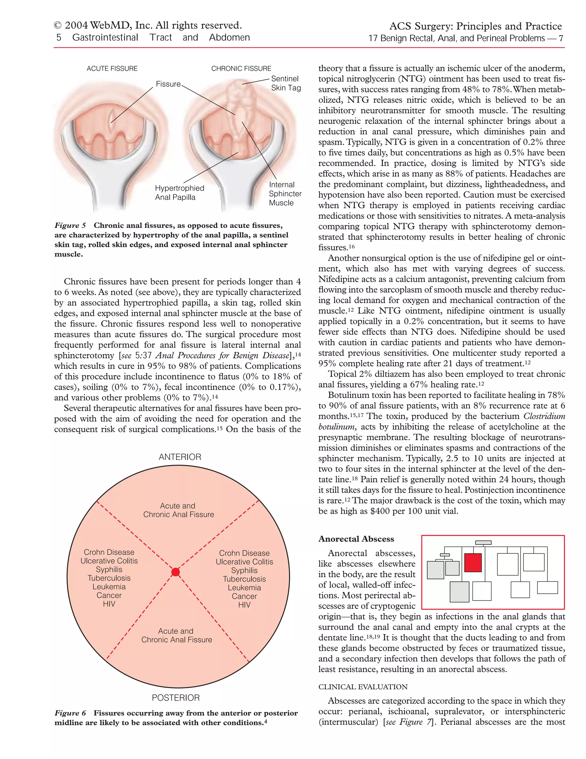 Acs0517 Benign And Malignant Rectal, Anal, And Perineal Problems 2004 | PDF