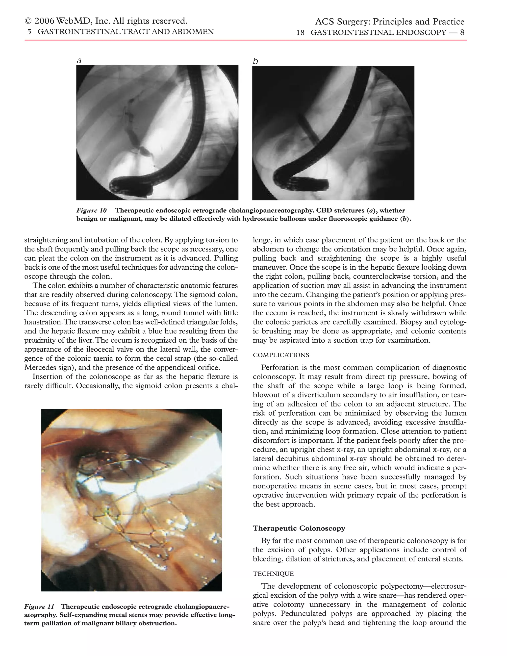 Acs0518 Gastrointestinal Endoscopy 2006 | PDF