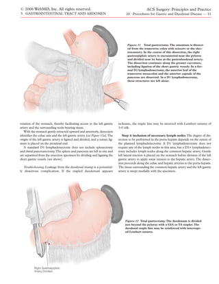 Acs0520 Procedures For Benign And Malignant Gastric And Duodenal ...