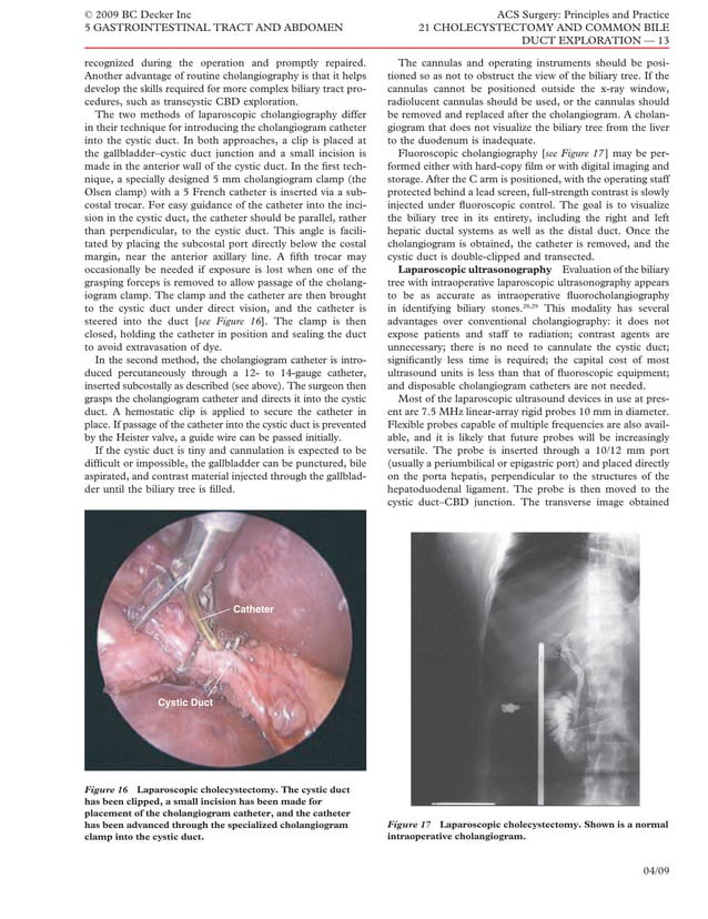 Acs0521 Cholecystectomy And Common Bile Duct Exploration 2009 | PDF