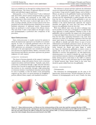 Acs0521 Cholecystectomy And Common Bile Duct Exploration 2009 | PDF