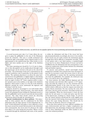 Acs0521 Cholecystectomy And Common Bile Duct Exploration 2009 | PDF