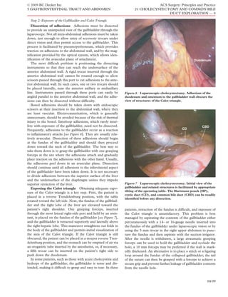 Acs0521 Cholecystectomy And Common Bile Duct Exploration 2009 | PDF