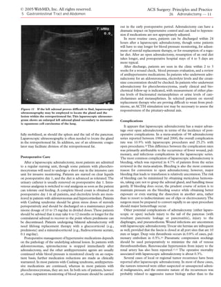 Acs0526 Adrenalectomy 2005 | PDF