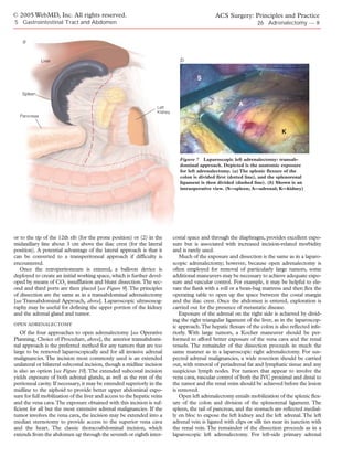 Acs0526 Adrenalectomy 2005 | PDF