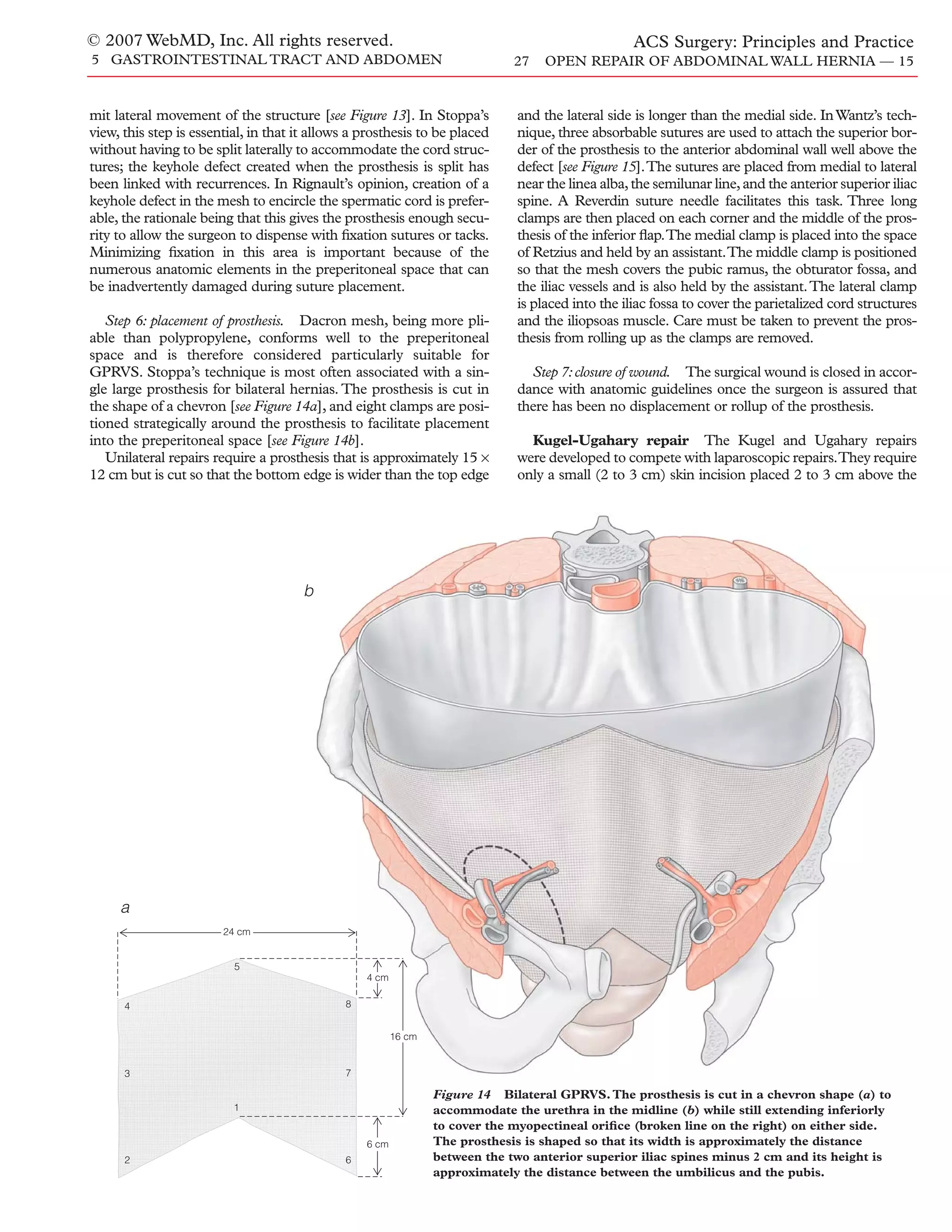 Acs0527 Open Repair Of Abdominal Wall Hernia 2007 | PDF