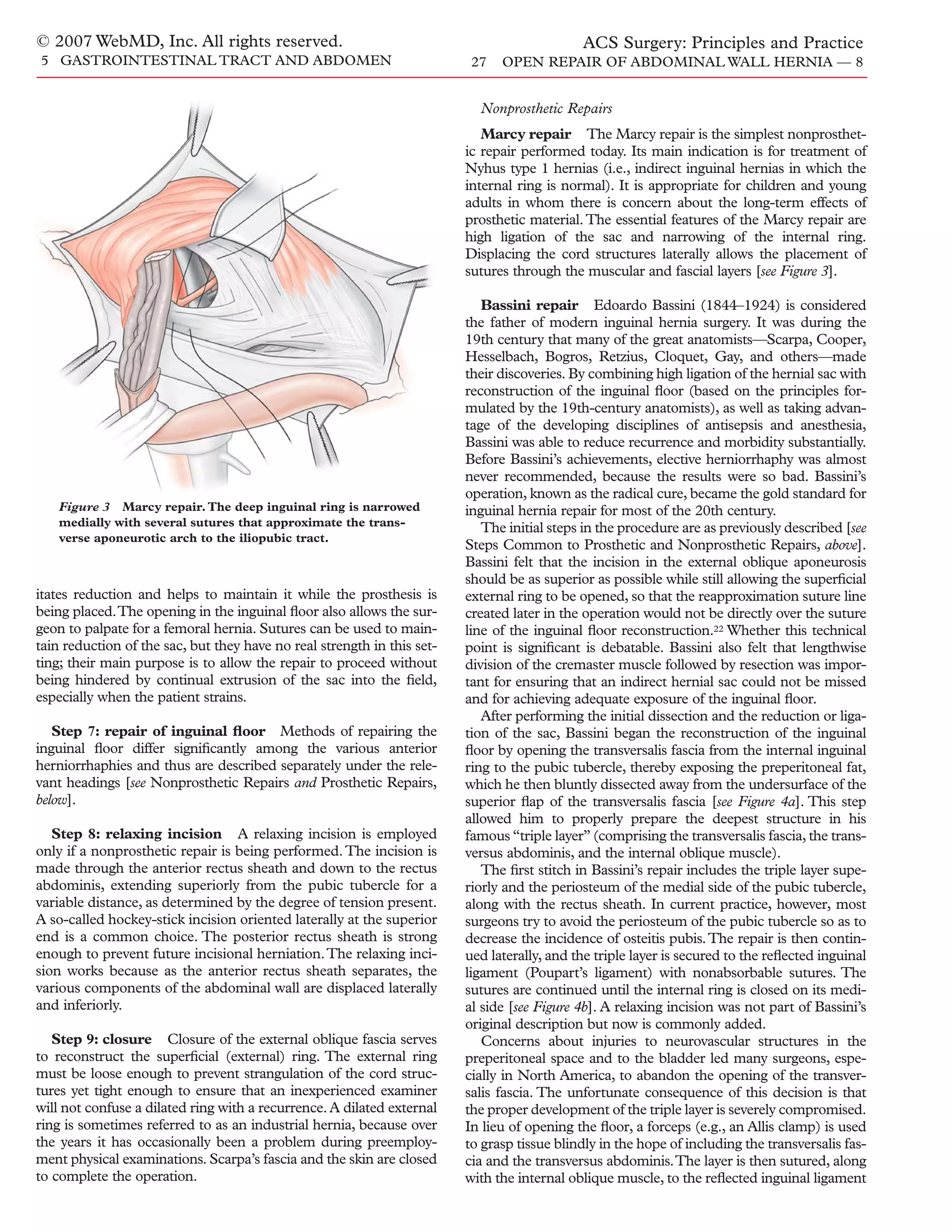 Acs0527 Open Repair Of Abdominal Wall Hernia 2007 | PDF
