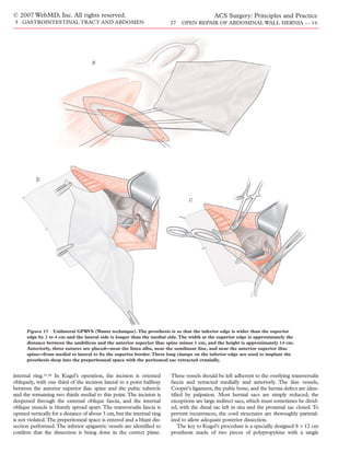 Acs0527 Open Repair Of Abdominal Wall Hernia 2007 | PDF