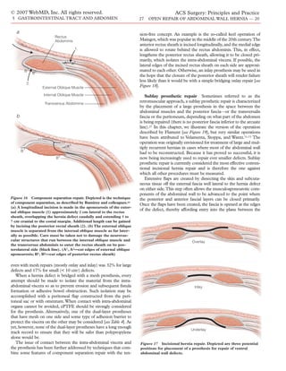 Acs0527 Open Repair Of Abdominal Wall Hernia 2007 | PDF
