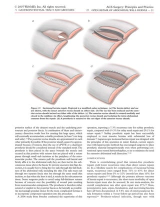 Acs0527 Open Repair Of Abdominal Wall Hernia 2007 | PDF