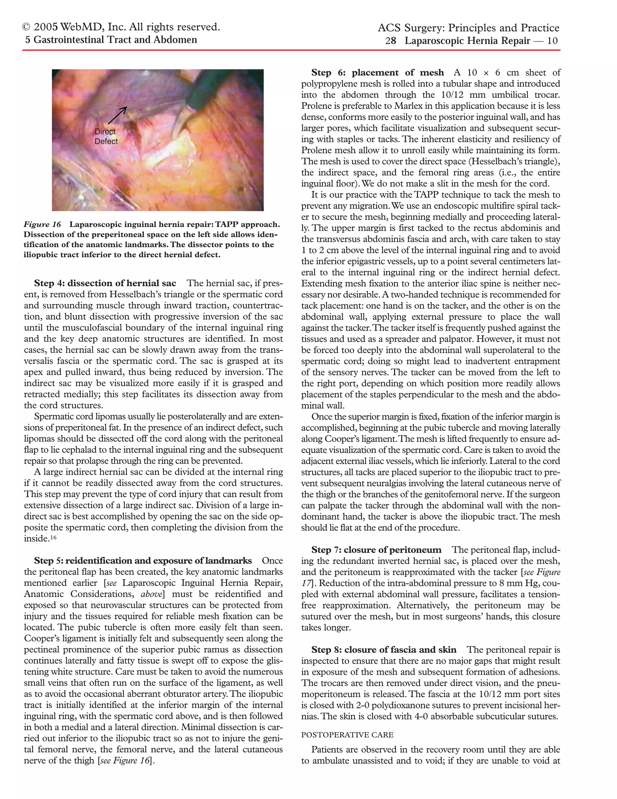 Acs0528 Laparoscopic Hernia Repair 2005 | PDF
