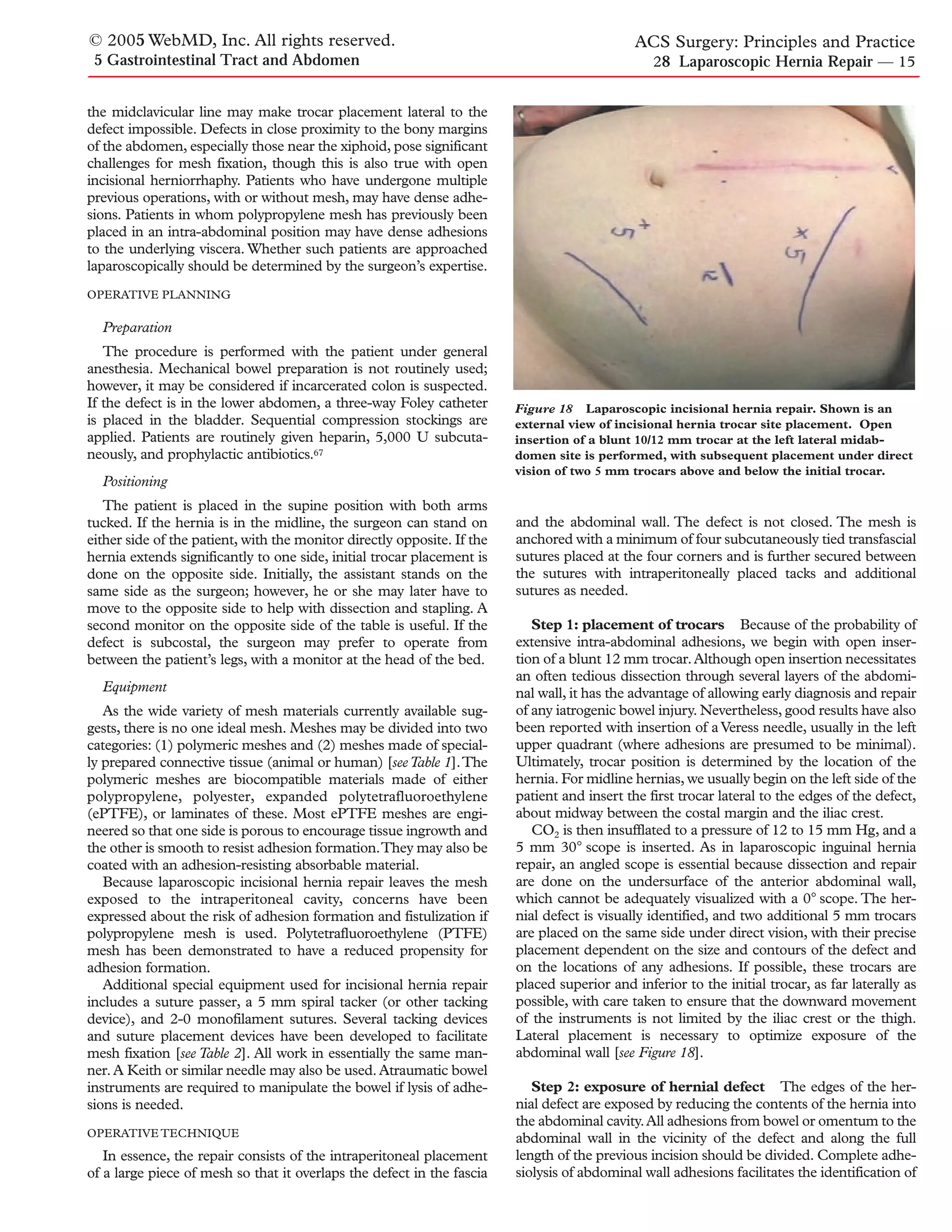 Acs0528 Laparoscopic Hernia Repair 2005 | PDF