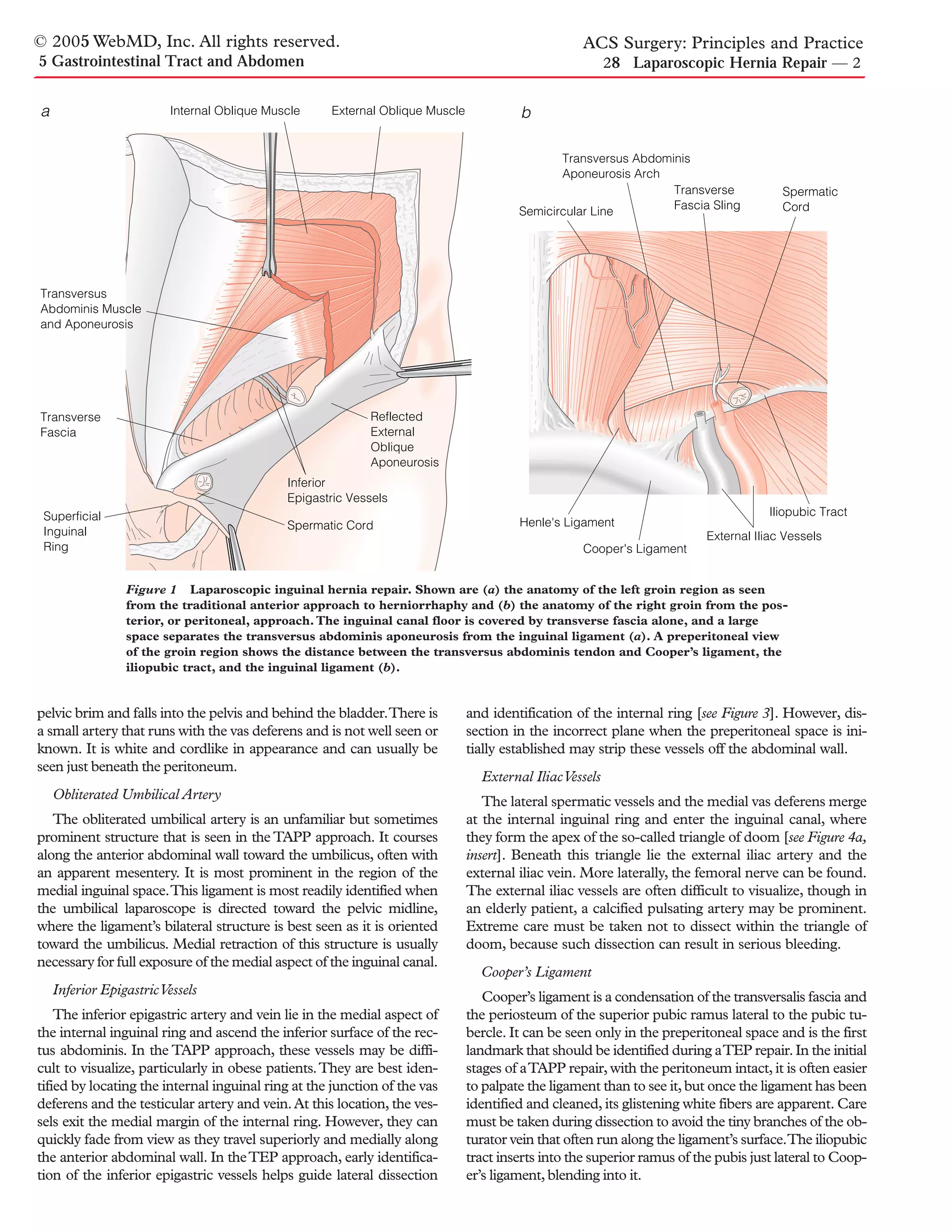 Acs0528 Laparoscopic Hernia Repair 2005 | PDF | Death, Injury, or Military Conflict | Sensitive ...
