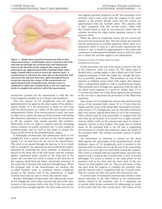 Acs0529 Intestinal Anastomosis 2008 | PDF | Digestive Disorders ...