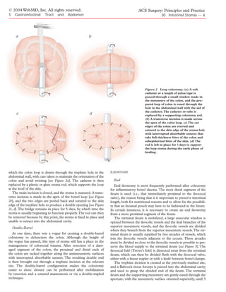 Acs0530 Intestinal Stomas 2004 | PDF